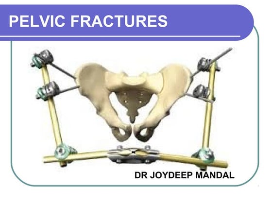 Various Pelvic lines | DOC