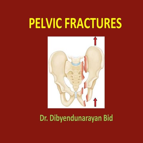 Pelvic fractures and Physiotherapy | PPTX