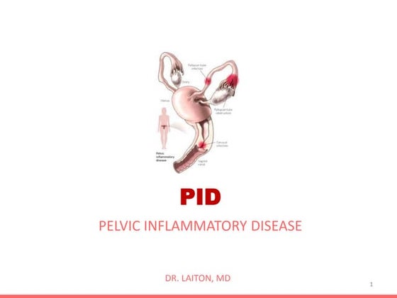 Homan’s Sign for DVT.pptx | Medical Health
