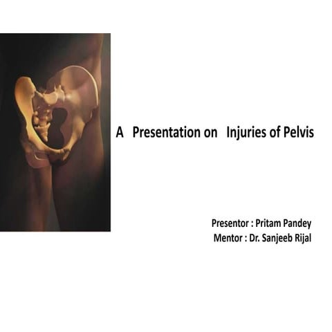 Pelvic injuries | PPTX