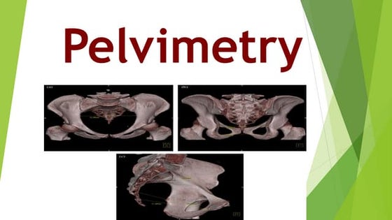 Obstetrical pelvic measurements | PPT