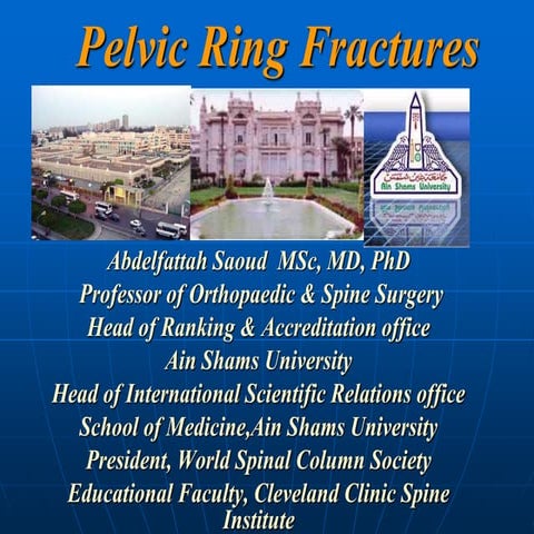 Pelvic fracture classification | PPTX