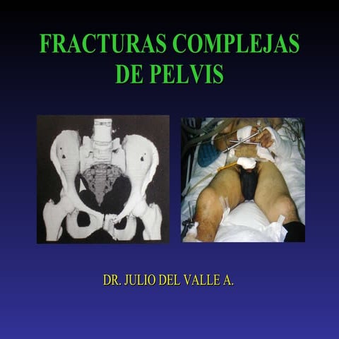 Evaluación radiográfica de la pelvis | PPTX