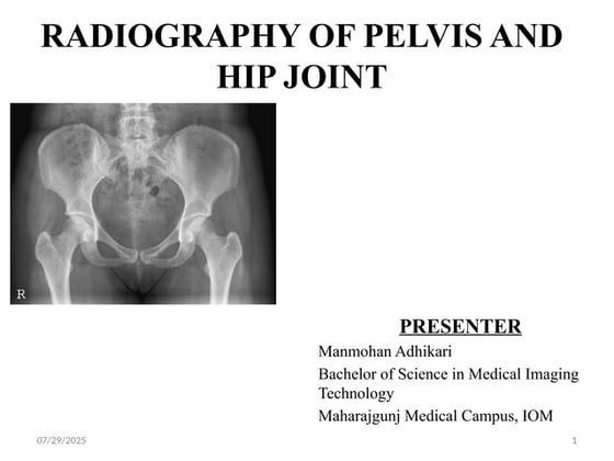Radiographic views of sacrum and coccyx | PPTX