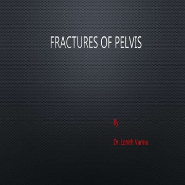 Pelvis fractures | PPTX