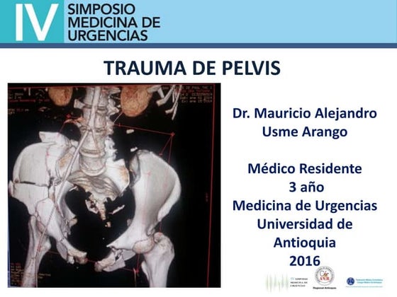ATENEO POLITRAUMATIZADO PELVIS () (1).pptx