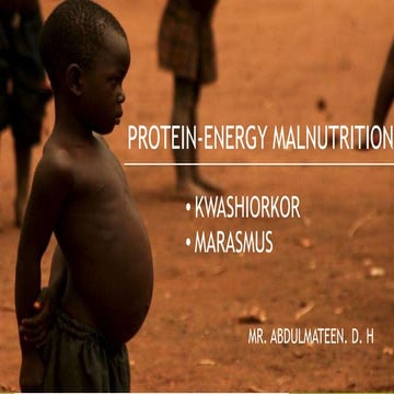 Protean energy malnutrition (PEM) Child Health Nursing.pptx