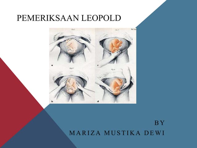 Denver ii indonesia | PDF