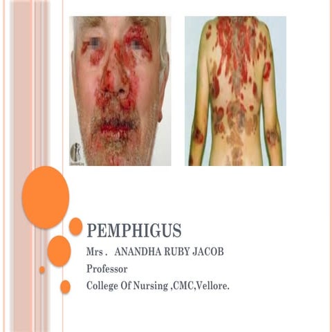 PEMPHIGUS.pptx for nursing students derm | PPTX