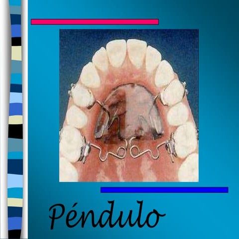 Arco facial extra oral | PPTX