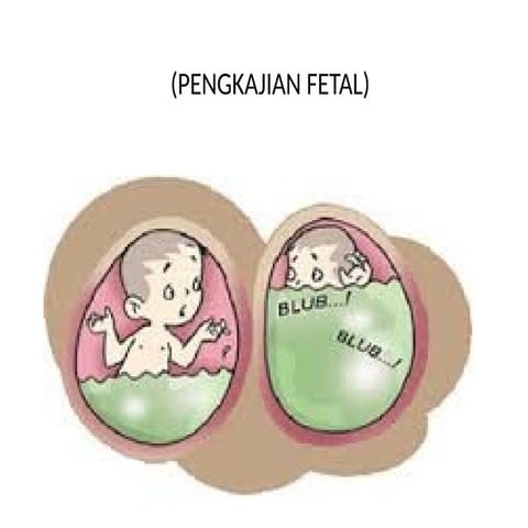 Kardiotokografi | PPTX