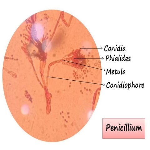 Penicillium Conidia Labeled
