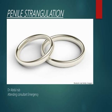 Penile strangulation | PPTX