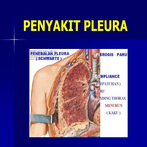 420549310-PPT-ASKEP-Efusi-Pleura.pptx
