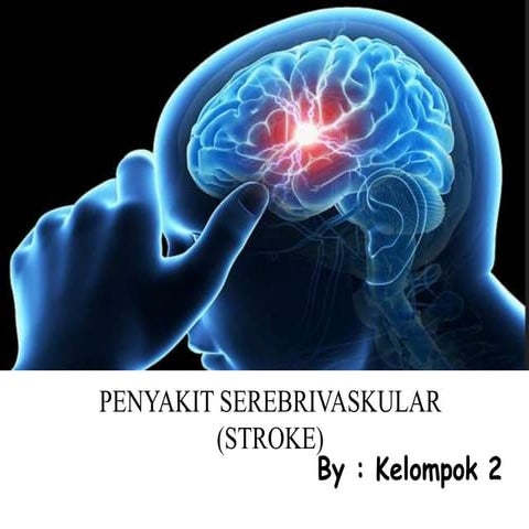 PENYAKIT_SEREBRIVASKULAR_STROKE_pptx.pptx