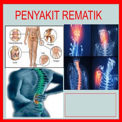 penyuluhan-rematik.pptx
