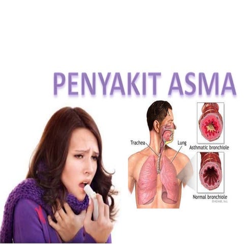 penyuluhan asma.pptx, pencegahan terhadap serangan asma | PPTX