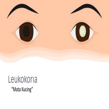 Penyuluhan Leukocoria untuk masyarakat awam | PPTX