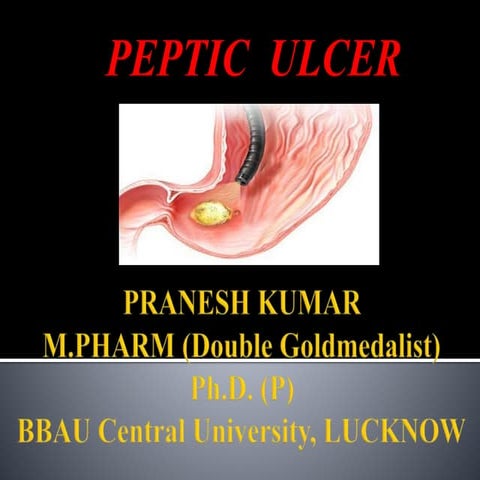 Peptic ulcer | PPTX