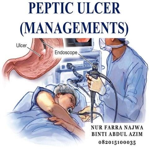 Peptic ulcer | PPT