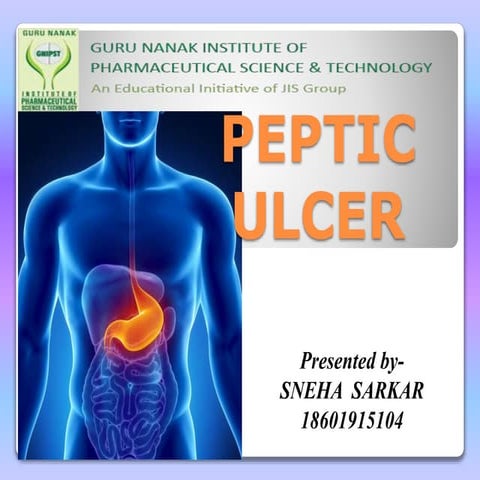 Peptic ulcer | PPT
