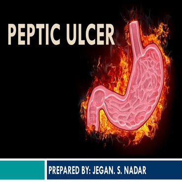 Pathophysiology of Peptic ulcer | PPT