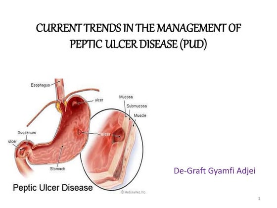 Rectal bleeding, colon cancer | PPT