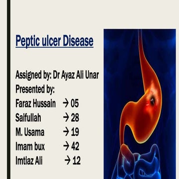 Peptic ulcers, it's diagnosis, treatment | PPT