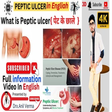 Peptic Ulcer treatment symptoms and privention | PDF | Digestive ...