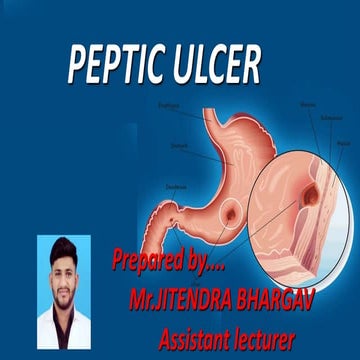 PEPTIC ULCER SLIDESHARE | PPTX