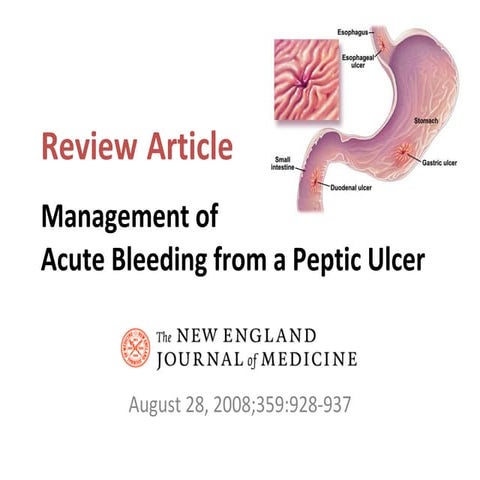 Peptic Ulcer Bleeding | PPT