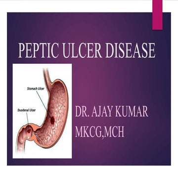 Peptic Ulcer Disease Ulcer Disease Gastrointestinal Society