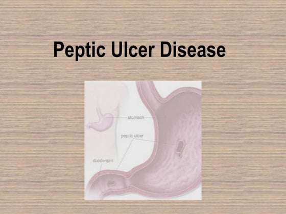 Anti ulcer drugs classification | PPT | Digestive Disorders | Diseases ...