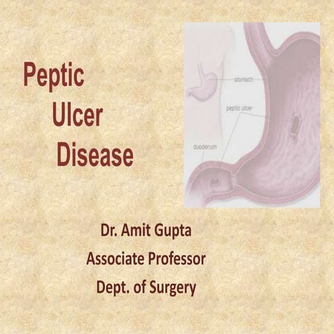 peptic_ulcer_disease (2).ppt