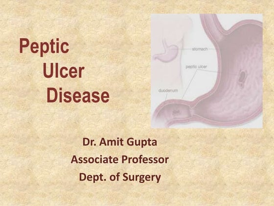 Peptic ulcers.pptx