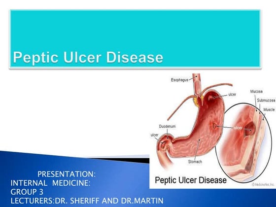 Management of Acute Exacerbation of Peptic Ulcer Disease (PUD) | PDF ...
