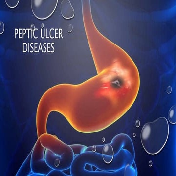 peptic ulcer mohammad abu sad 1.pptx