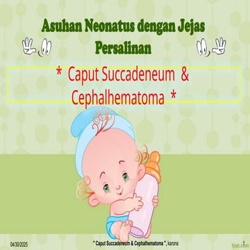 Caput sucadenum dan cephal hematom.pptxx | PPTX