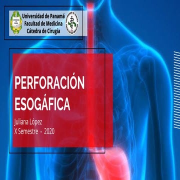 Perforacion esofagica | PPTX