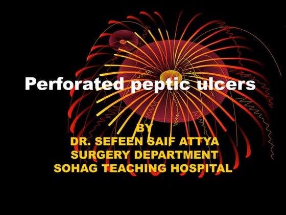 Management of Acute Exacerbation of Peptic Ulcer Disease (PUD) | PDF ...