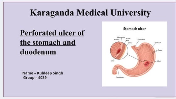 Most Common Peptic Ulcer Disease Symptoms | The Lifesciences Magazine | PDF