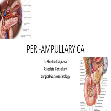 PERI-AMPULLARY CARCINOMA | PPTX