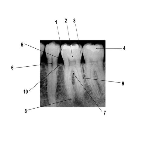 Periapical Radiograph.ppt
