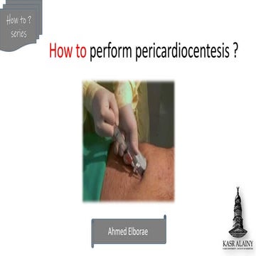 How to perform pericardiocentesis step-by-step | PPT