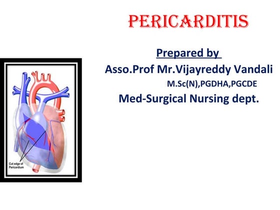 Pericarditis | PPTX