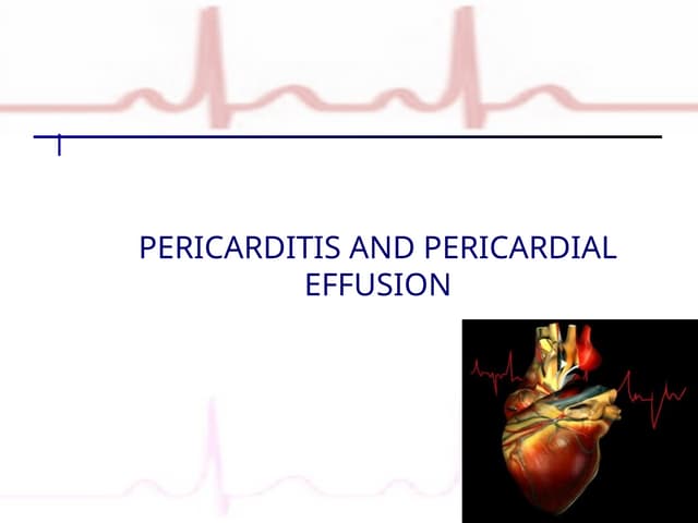 Pericarditis | PPTX