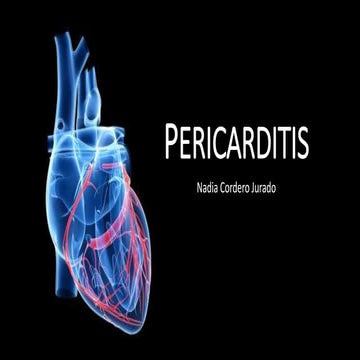 Pericarditis | PPTX
