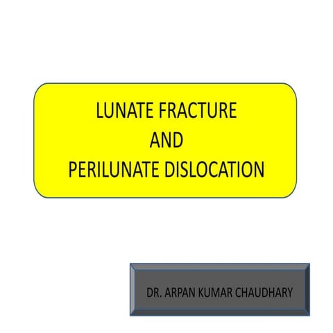 Lunate Fracture & Perilunate dislocation of carpals by Dr.@rpan ...