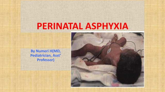 Hypoxic Ischemic Encephalopathy | PPTX