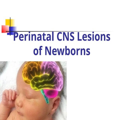 Ppt on Perinatal CNS Lesions of Newborns.pptx
